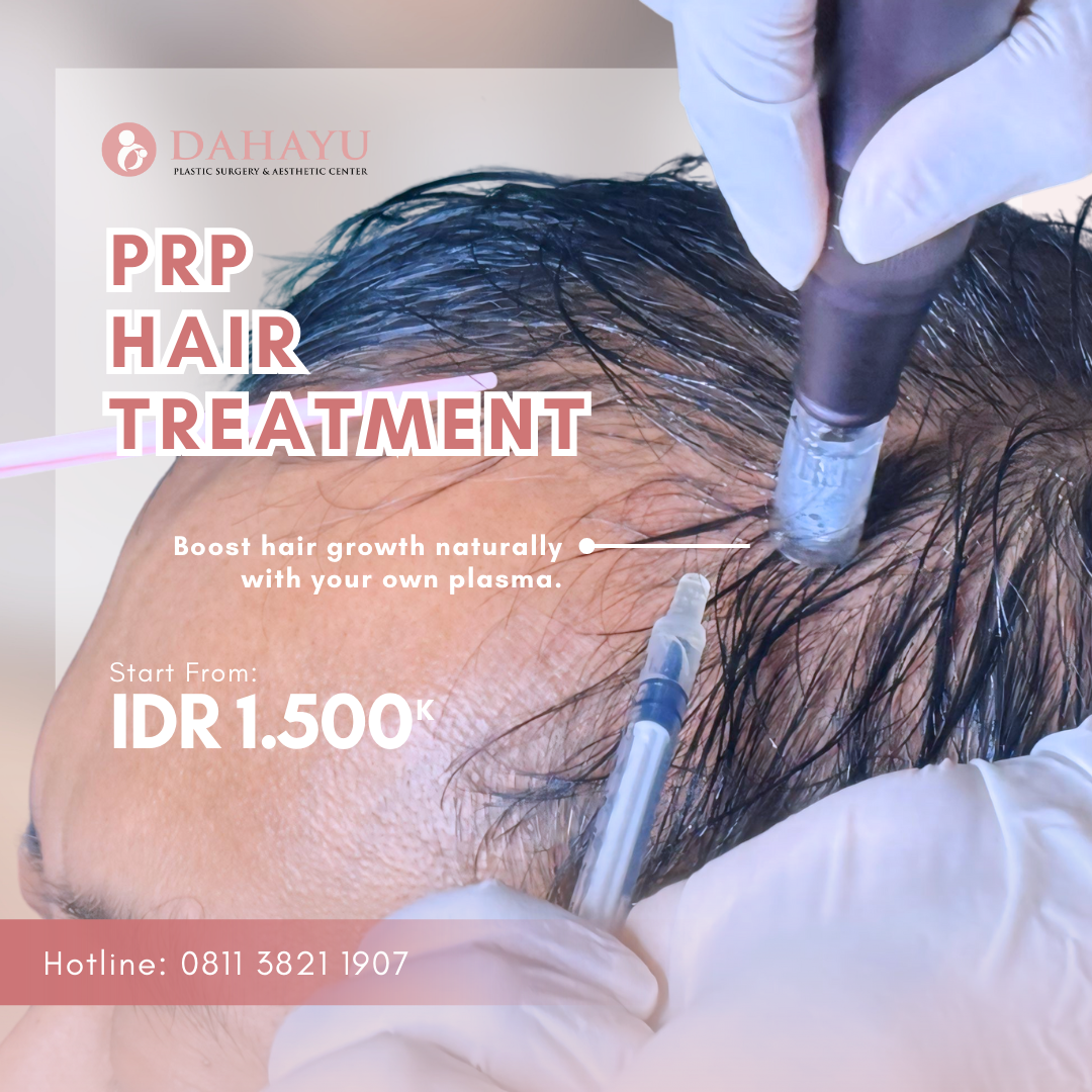 PRP (Platelet-Rich Plasma) Hair Treatment - Puri Bunda Hospital